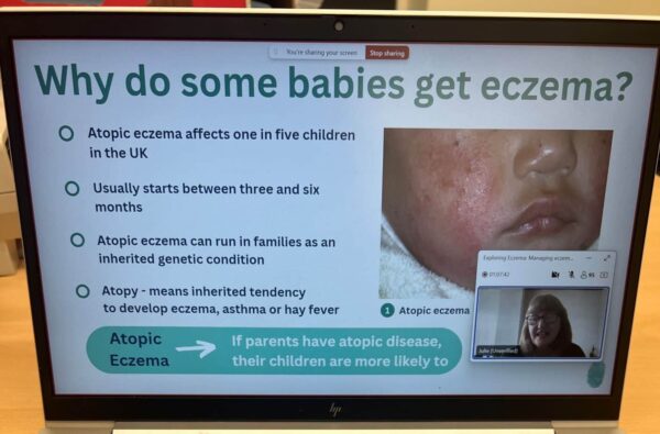 We launched our Exploring Eczema webinars! - National Eczema Society
